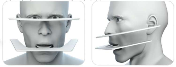 Fox Ruler ARFX0444 - POKA